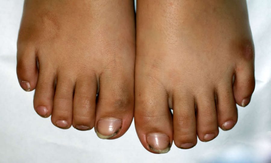 The Evil Effects of a Marathon to Your Human Body